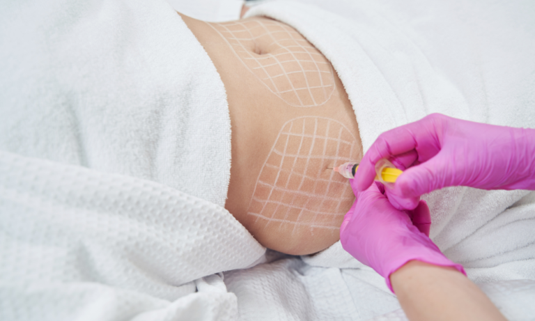 Ultimate Guide: FAT DISSOLVING MESOTHERAPY - BTS