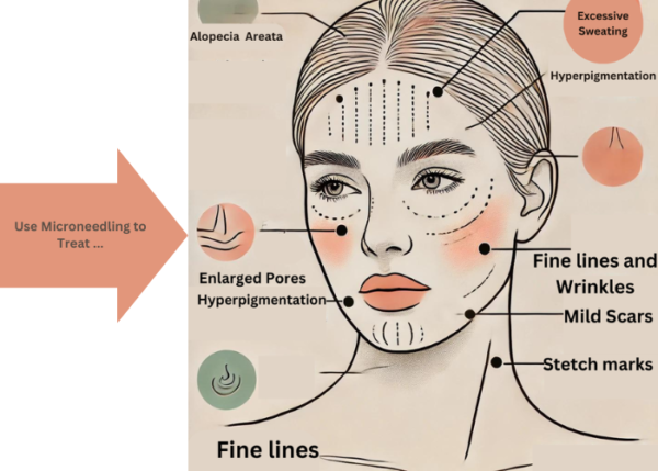 How much does microneedling cost? Average Costs 2024
